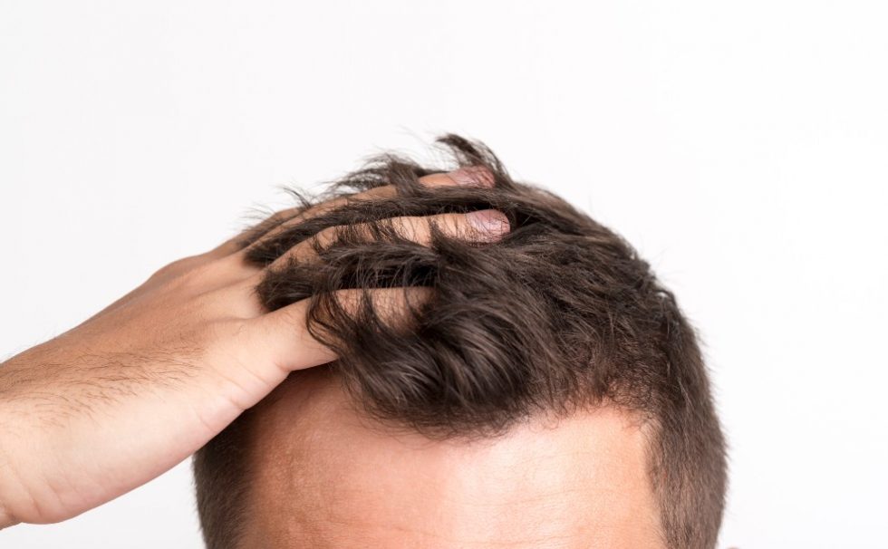 Descubre por qué se cae el pelo: 8 causas de la caída del cabello