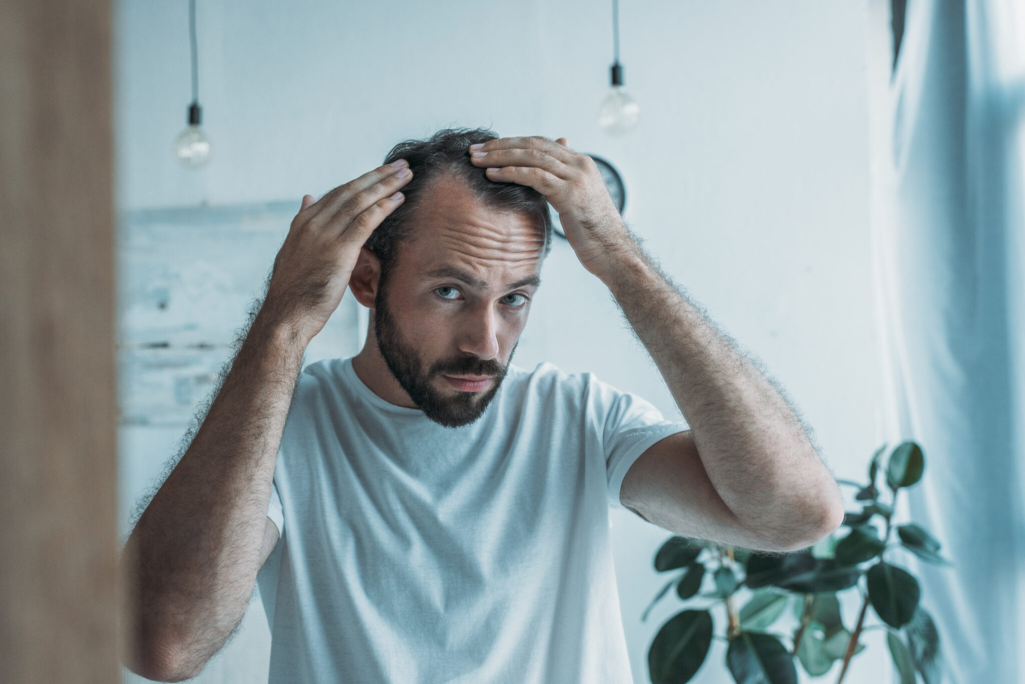 Diffuser Haarausfall- Wie lässt sich der Haarschwund aufhalten?