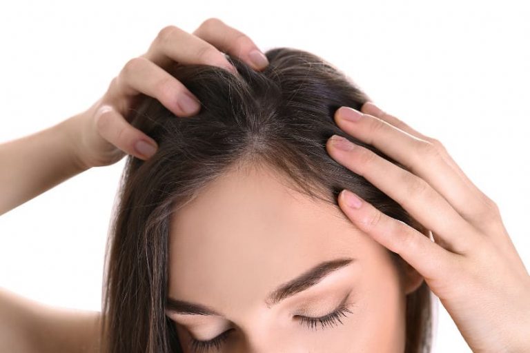 Erblich bedingter Haarausfall bei Frauen – Was hilft dagegen?
